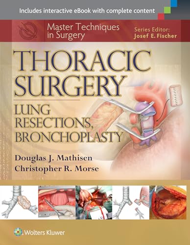 Master Techniques in Surgery: Thoracic Surgery: Lung Resections, Bronchoplasty By Douglas J ...