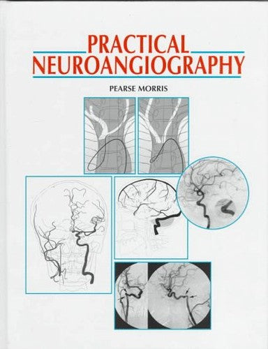 Practical Neuroangiography By Pearse Morris | 9780683300208 | World of ...