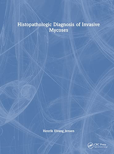 Histopathologic Diagnosis of Invasive Mycoses By Henrik Elvang Jensen ...