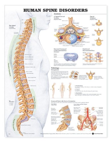 Human Spine Disorders Anatomical Chart By Anatomical Chart Company ...