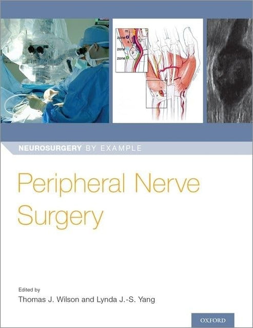 Peripheral Nerve Surgery By Thomas Wilson | World of Books US