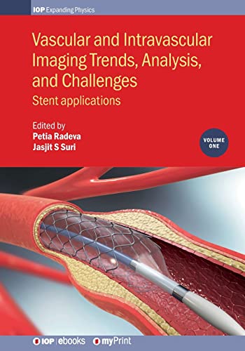 Vascular and Intravascular Imaging Trends, Analysis, and Challenges ...