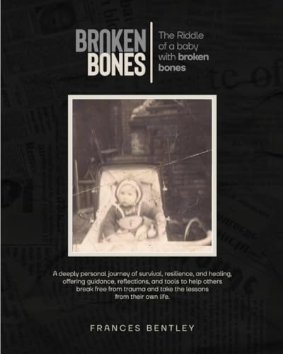Broken Bones: The riddle of baby with broken bones. By Bentley Frances ...