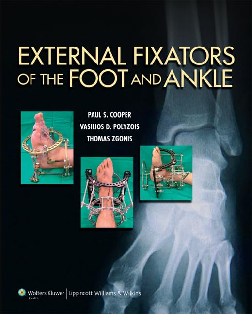 External Fixators of the Foot and Ankle By Paul Cooper | World of Books US