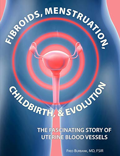Fibroids, Menstruation, Childbirth, and Evolution By Fred Burbank ...