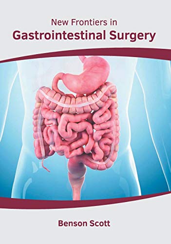 New Frontiers in Gastrointestinal Surgery By Benson Scott | World of ...