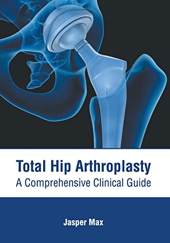 Total Hip Arthroplasty: A Comprehensive Clinical Guide By Jasper Max ...