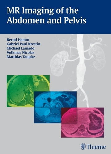 MR Imaging of the Abdomen and Pelvis By Bernd Hamm | World of Books AU