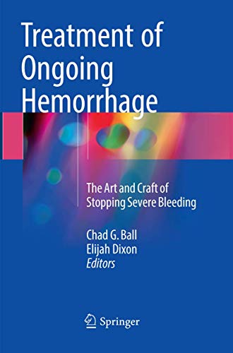 Treatment of Ongoing Hemorrhage By Chad G Ball | World of Books