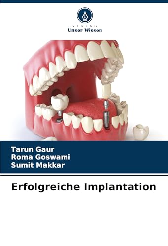 Erfolgreiche Implantation By Tarun Gaur | World of Books US