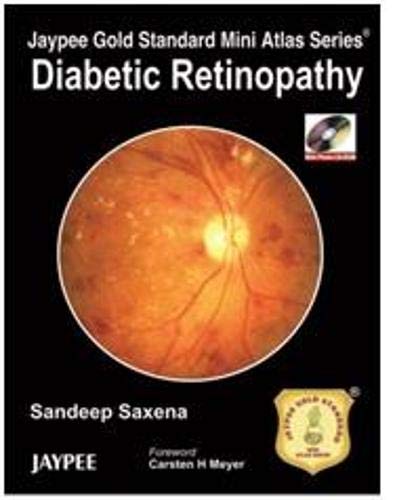Jaypee Gold Standard Mini Atlas Series: Diabetic Retinopathy By Sandeep ...