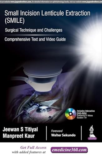 Small Incision Lenticule Extraction (SMILE): Surgical Technique and ...