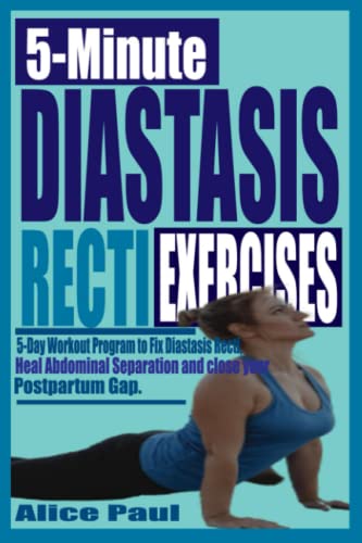 5-MINUTE DIASTASIS RECTI EXERCISES: 5-Day Workout Program to fix ...