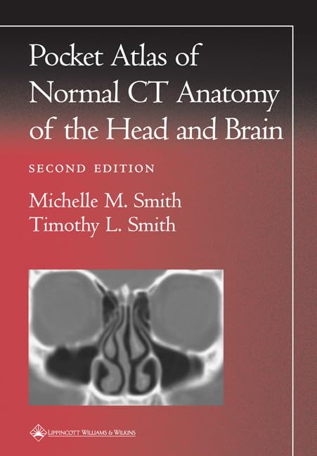 Pocket Atlas of Normal CT Anatomy of the Head and Brain By Michelle ...